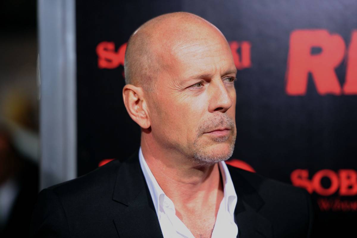 What these famous bald actors looked like with hair