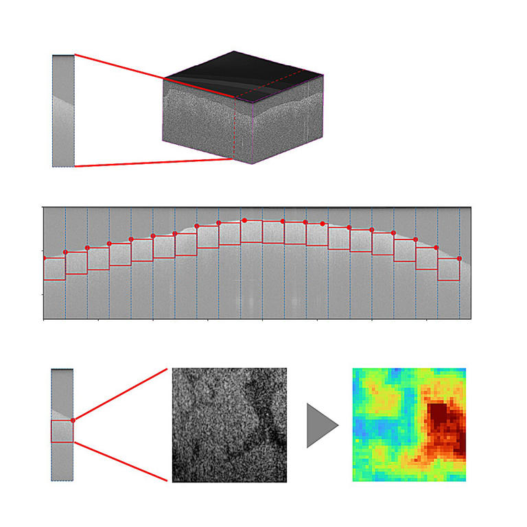 AI-based tissue anomaly detection may reduce duration of liver cancer ...