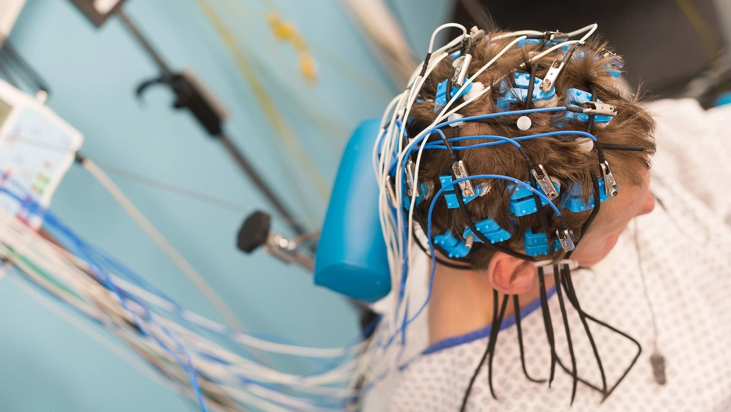 Recognizing and managing epilepsy risks