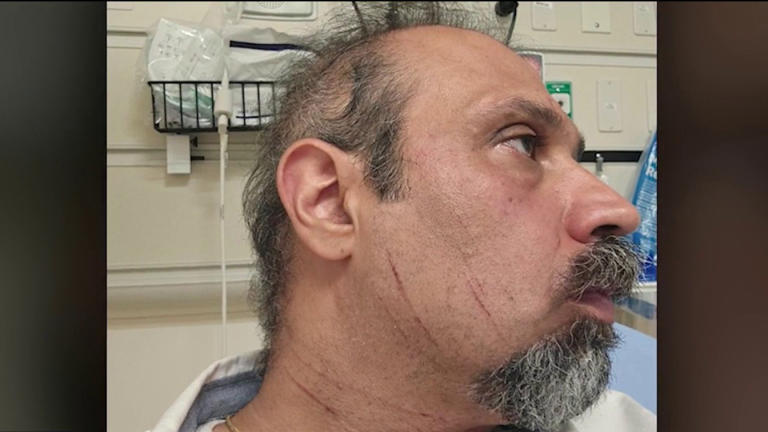 Atlanta driver survives savage ambush after posting criticism of ...