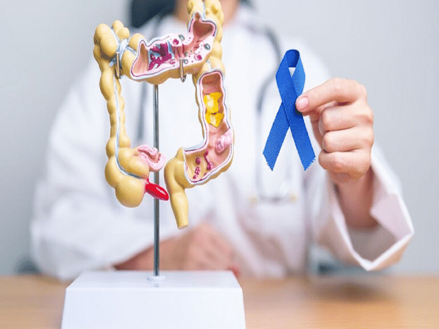 Colon cancer warning signs: Common digestive problems you should never ...