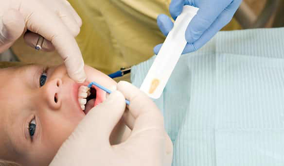 Years without fluoridated water show pattern of tooth decay experts ...