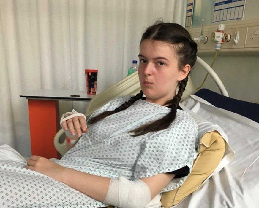 Teen’s migraines blamed on chocolate were sign of brain tumor