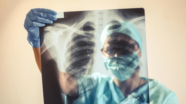 Hallan mutaciones en el virus causante de la neumonía «que le confieren ...