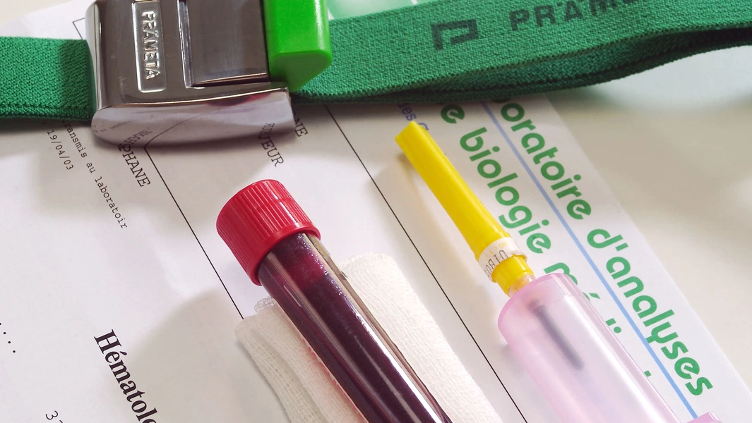 Recognizing and addressing iron deficiency anemia