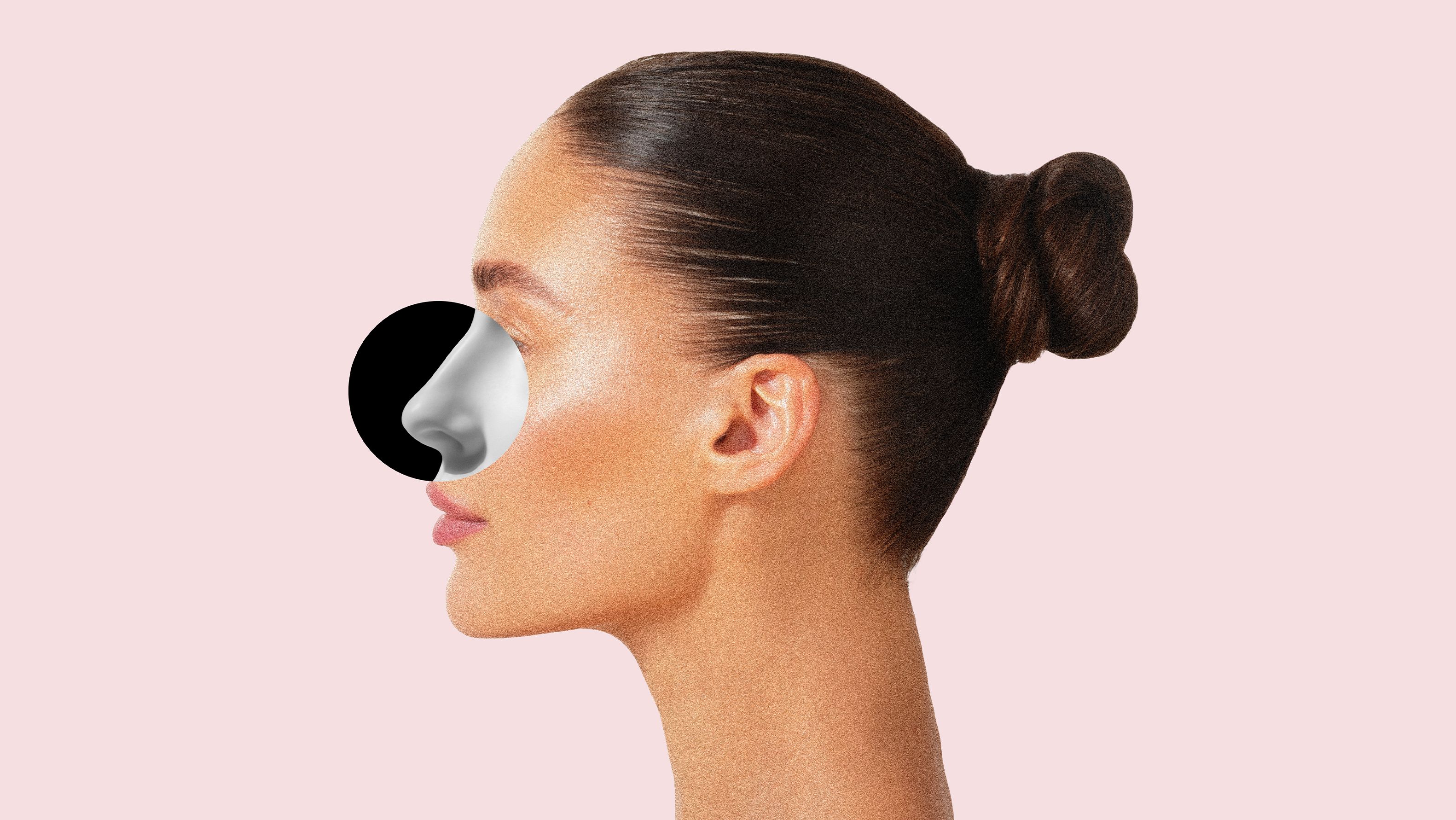 I got a revision rhinoplasty to fix my nose job