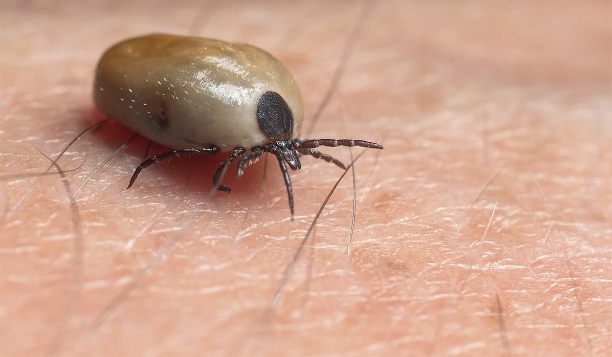 Urgent warnings as yet another American is hit with tick-borne ...