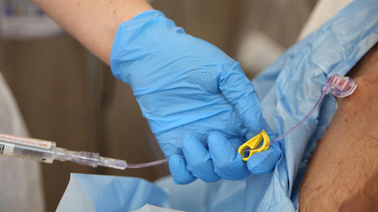 Evolution of perioperative immunotherapy in resectable esophageal cancer