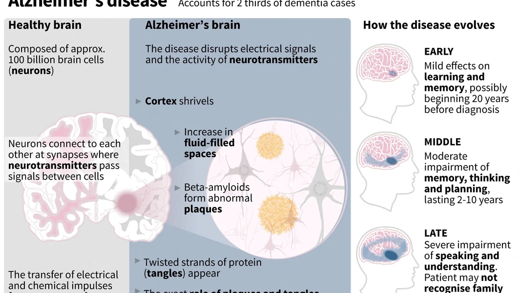 Emerging mechanisms and therapies for Alzheimer’s disease