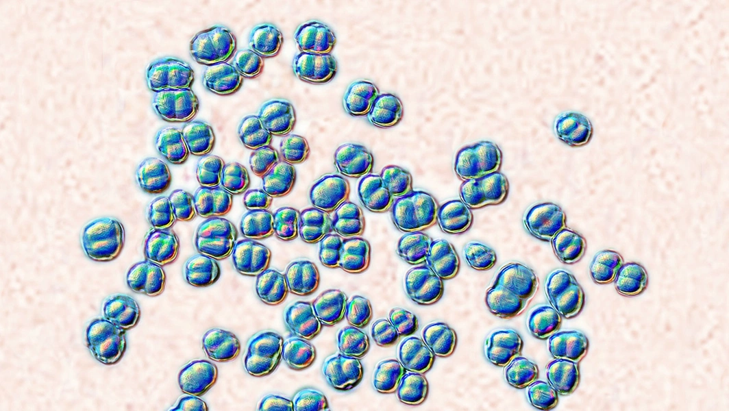 Recognizing and preventing bacterial meningitis