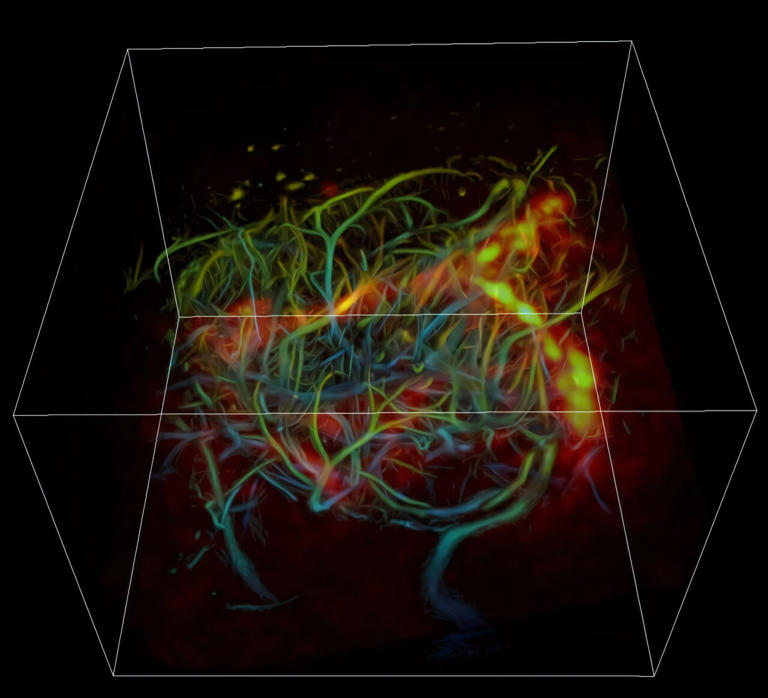 Tracking the flow of cerebrospinal fluid reveals an unprecedented view ...