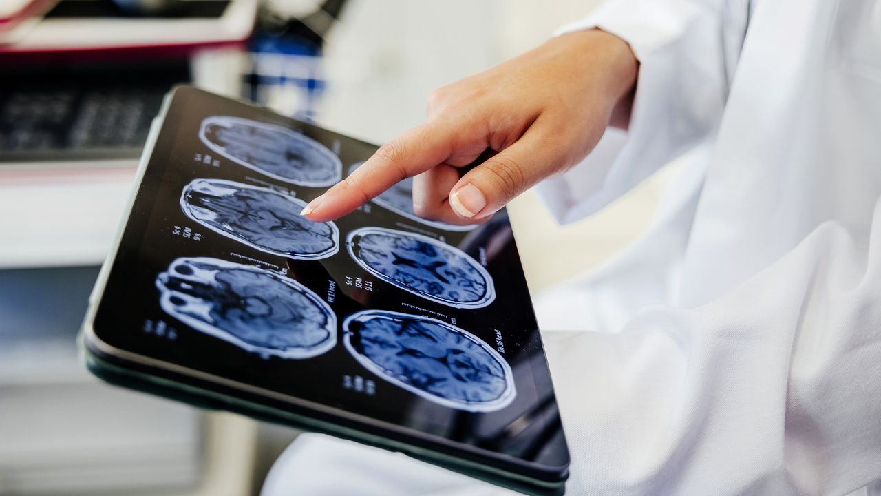 Drug-induced 'brain freeze' may help protect the brain after a stroke ...
