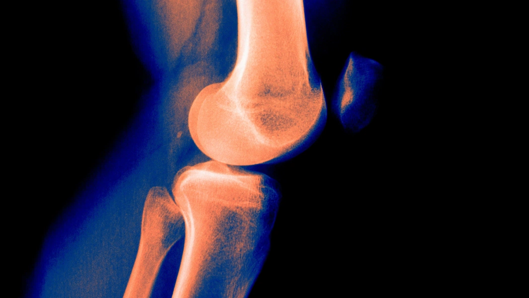 Maintaining strong, pain-free knees over time