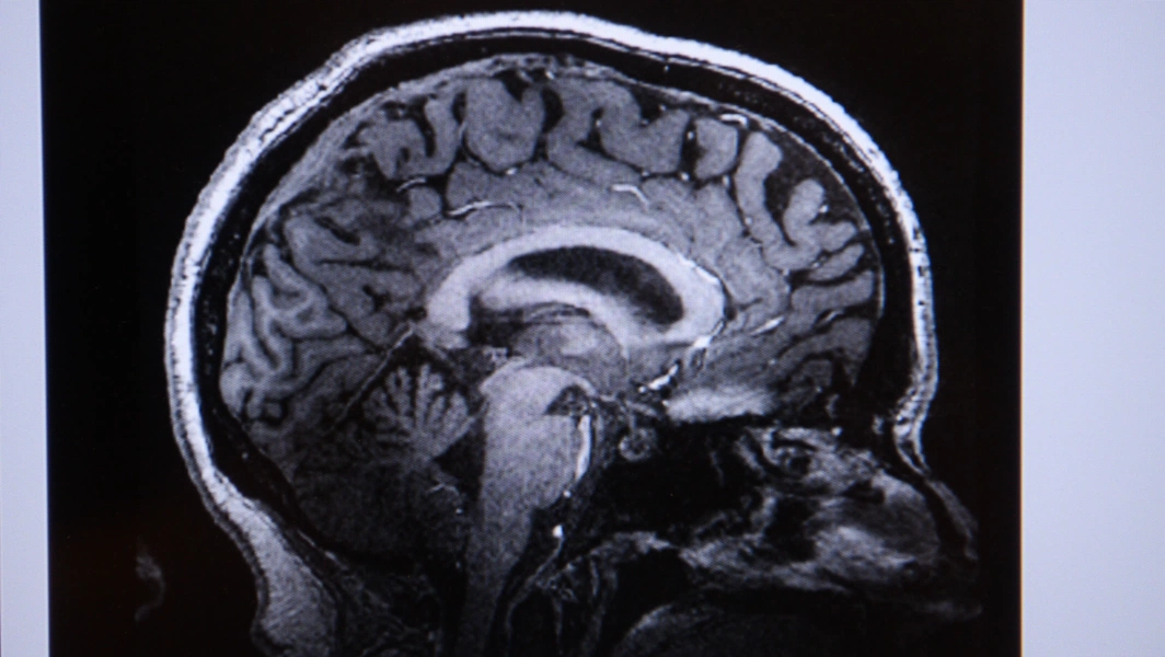 Science-based strategies for lifelong brain health