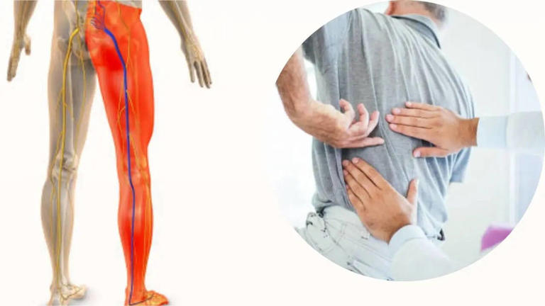 That pain shooting down your leg isn't normal: The hidden signs of sciatica