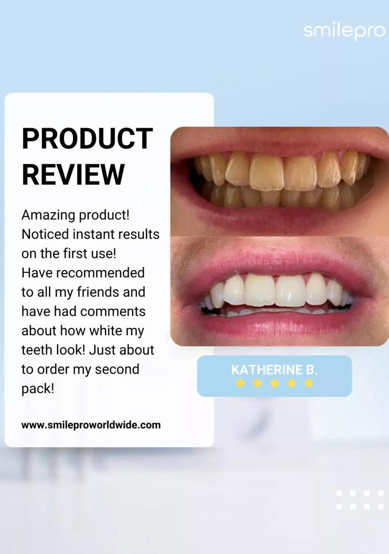 Award-winning teeth whitening kit drops to 60 per cent off: 'I noticed ...