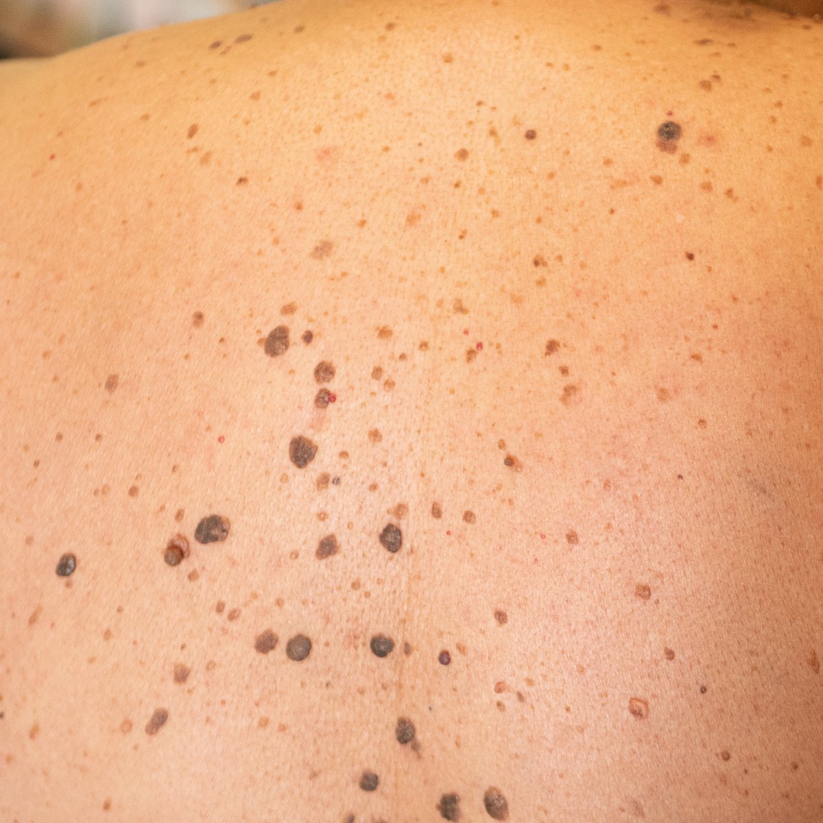 'I'm a skin doctor. We need to talk about the new way people are trying ...
