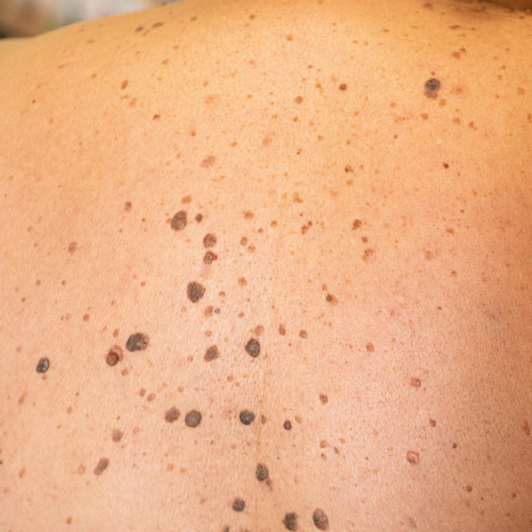 'I'm a skin doctor. We need to talk about the new way people are trying ...