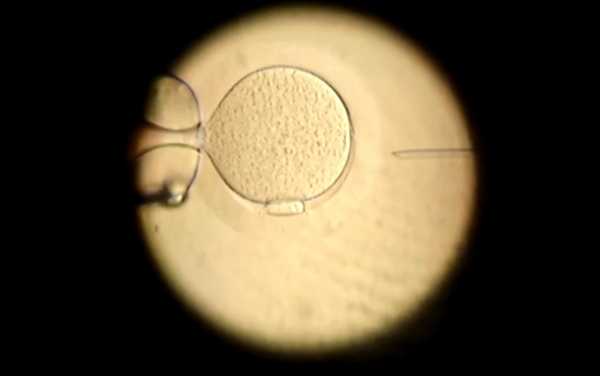 Pacientes pagam por complementos da fertilização in vitro sem evidência ...