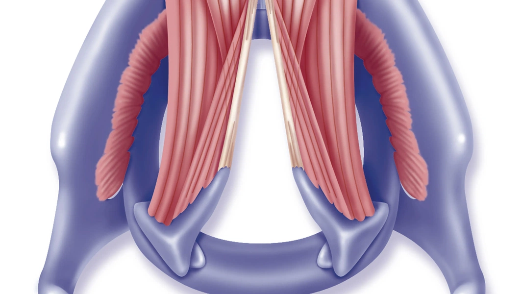 Understanding spasmodic dysphonia and its impact on speech