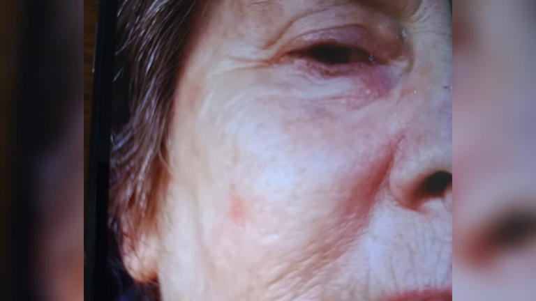 Does it seem easier to book a dermatologist for Botox than a mole check ...