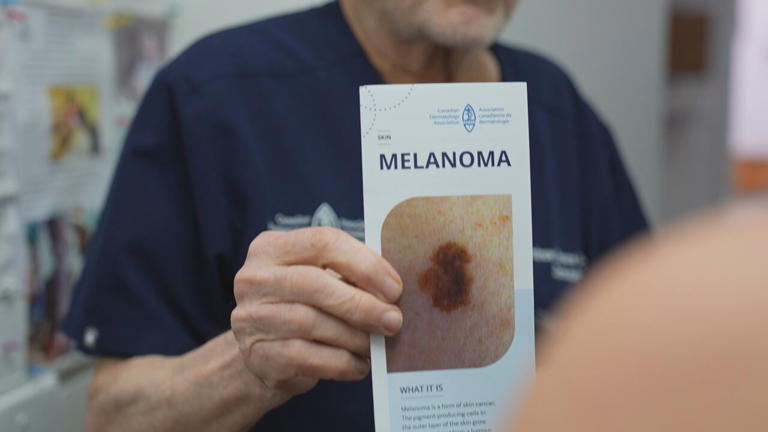 Does it seem easier to book a dermatologist for Botox than a mole check ...
