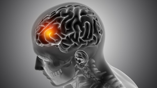 Kolkata neurosurgeon with over 36 years of experience explains brain ...