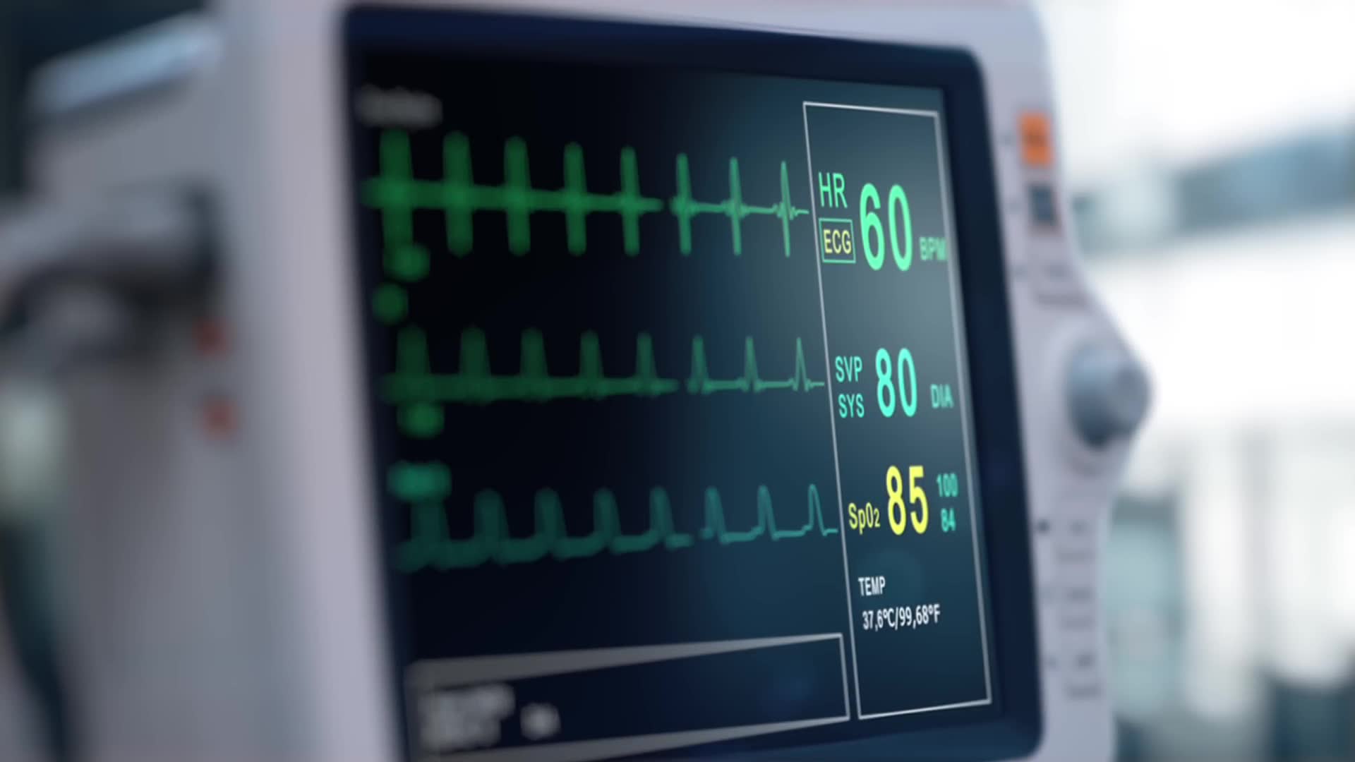 The truth about Max heart rate formula that most articles get wrong