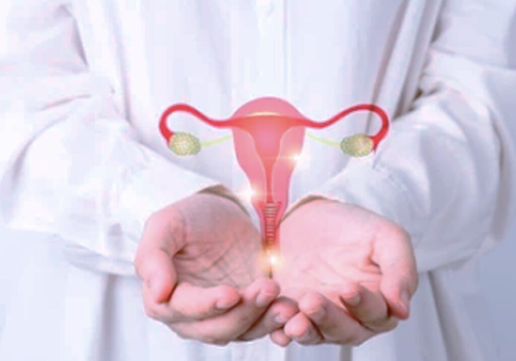 Nuova terapia per il cancro all’ovaio al Gemelli: come funziona il ...