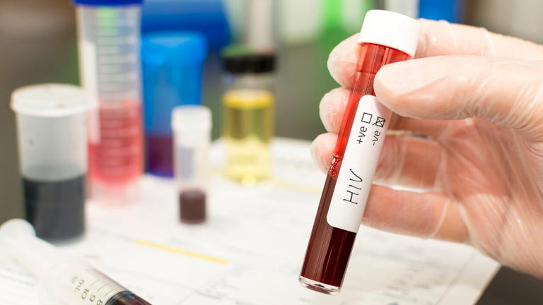 Public health officials expand access to free HIV testing