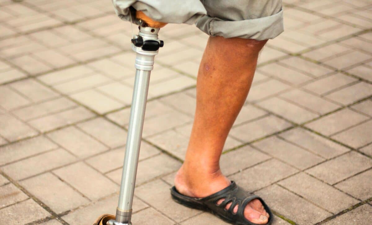 The human body may already know how to regrow lost limbs and scientists ...