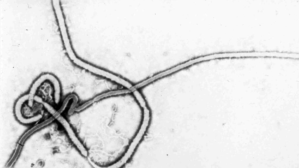 Virus Ebola : premier cas détecté en France chez un médecin de retour ...
