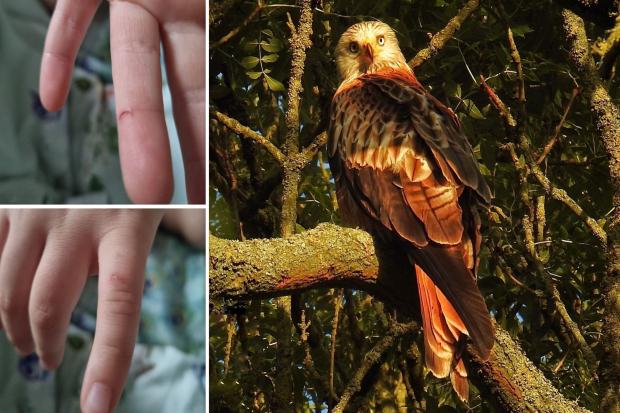 Girl, 7, 'terrified' of eating outside after red kite snatches food out ...