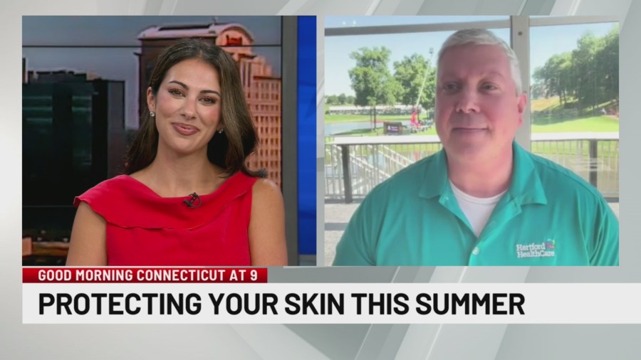 Tips for taking care of your skin during warm weather