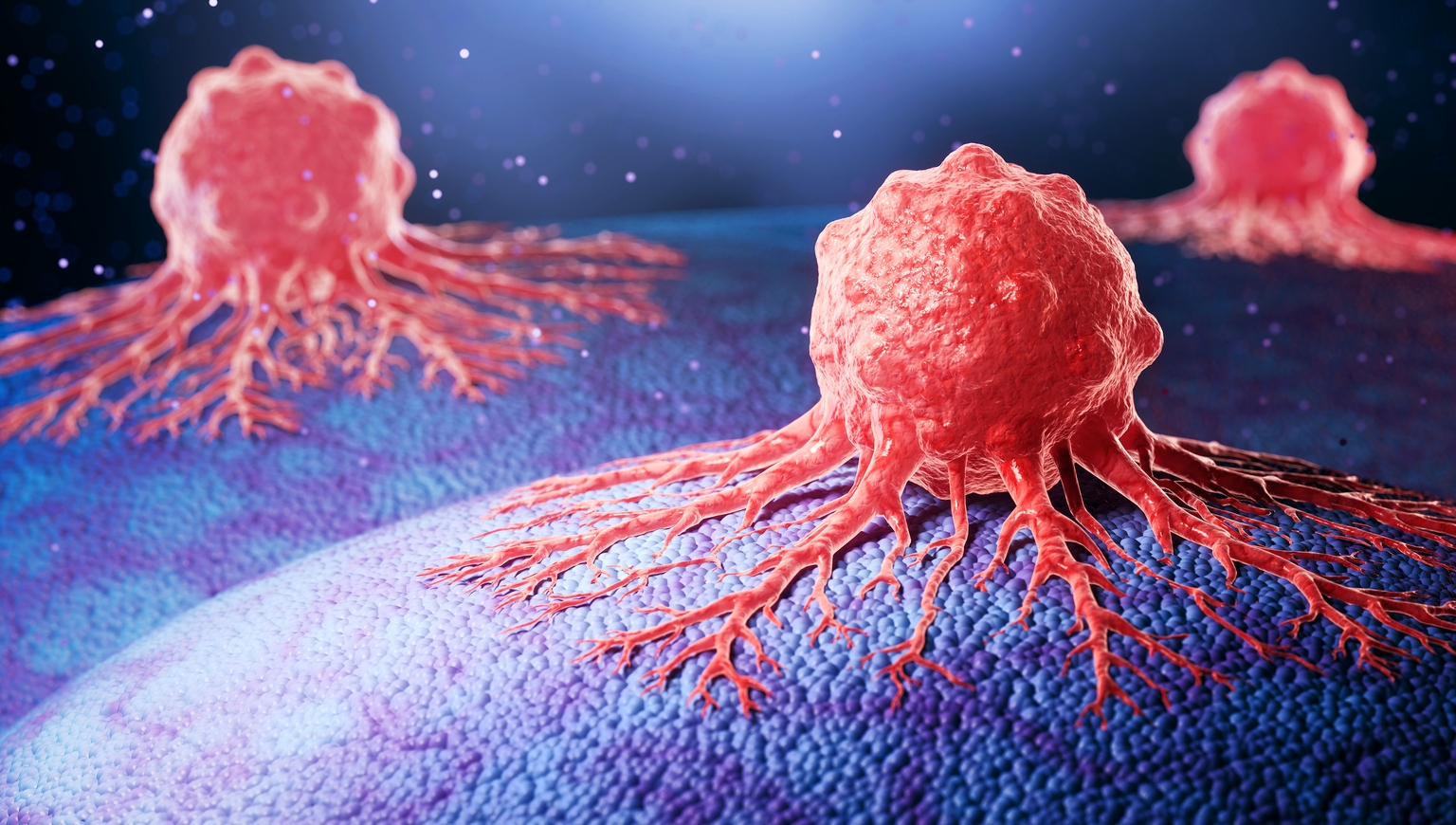 Quest Diagnostics receives New York approval for Haystack MRD cancer ...