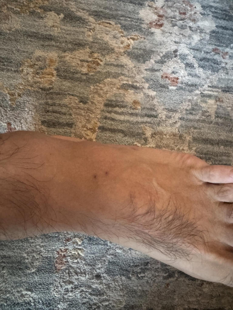 Pilot bitten by bat after swarm invades his Sheraton hotel room ...
