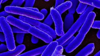 Portion of Koreatown in Los Angeles under boil water notice for E coli ...