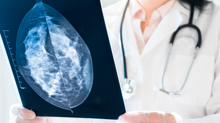 Research says AI may detect breast cancer warning signs six years ...