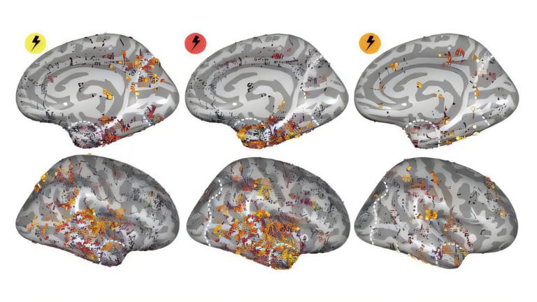 Study identifies new brain targets for individualized epilepsy treatment