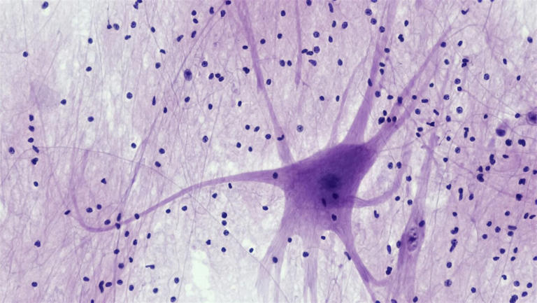 Fear-learning circuit shows how stress disrupts brain's ability to ...