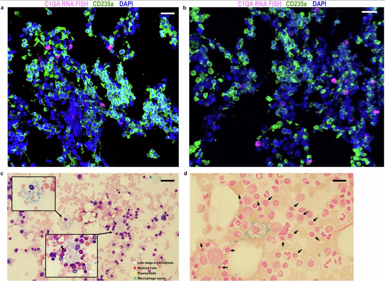Human red blood cells form without central 'hub' seen in mouse models ...