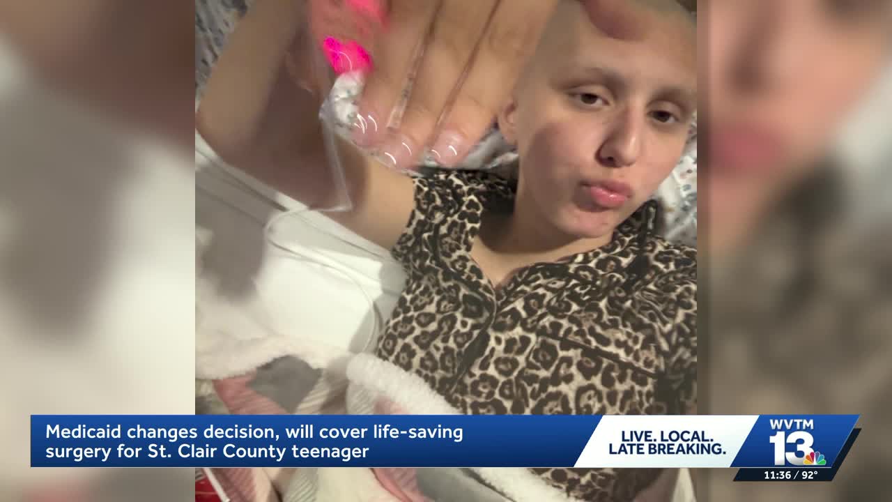 Medicaid to cover lifesaving surgery for Alabama teen