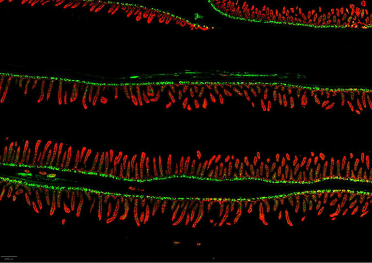 Gut bacteria linked to malnutrition may pass to younger generations
