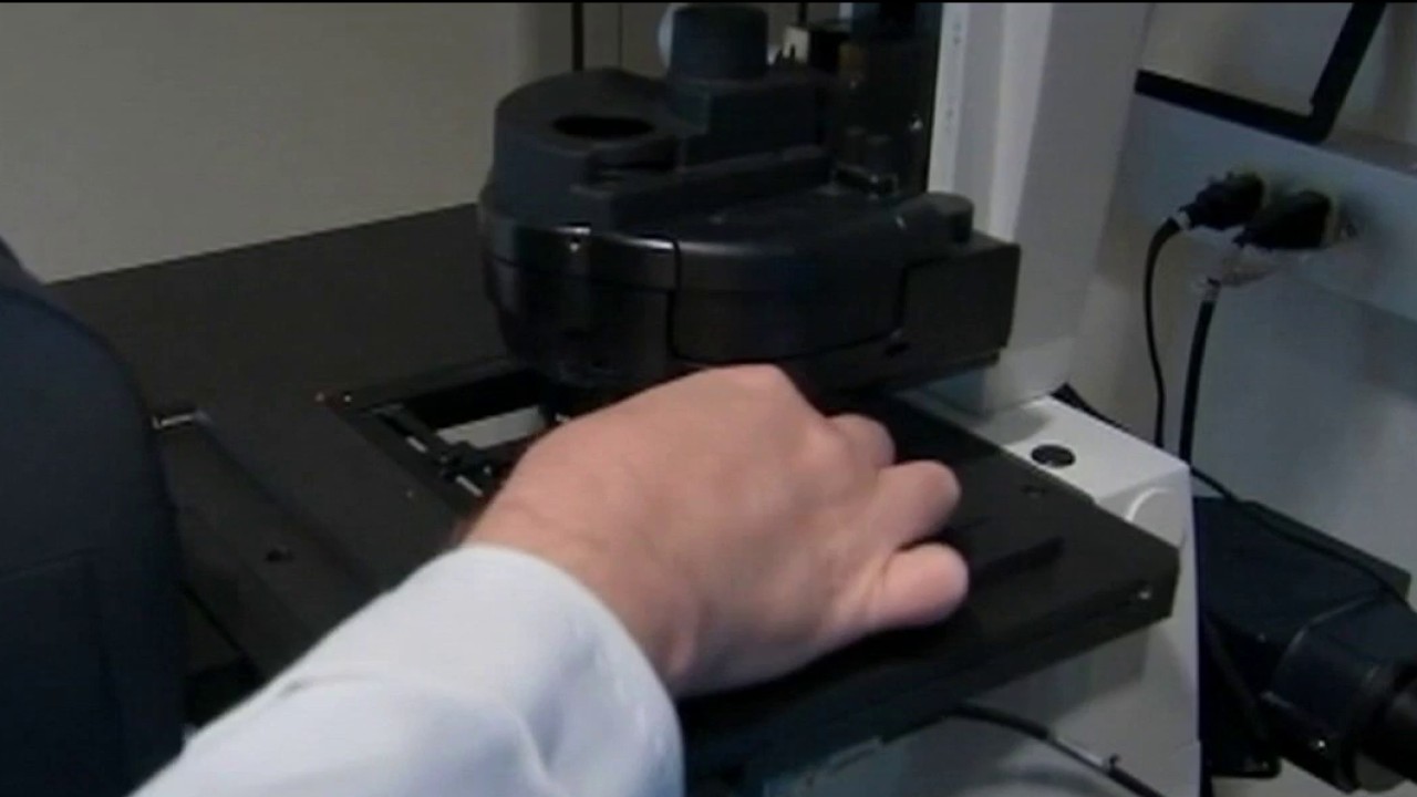 New at-home test expands cervical cancer screening options