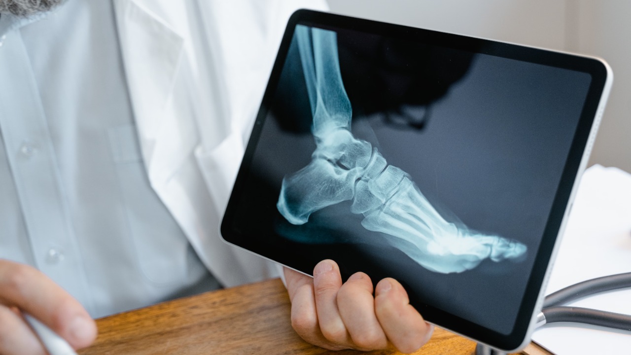 A quarter of the bones in your body are in your feet, 26 in each one