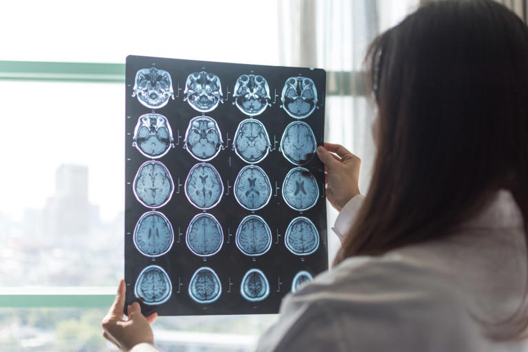 Researchers uncover new lifestyle factor that could affect Alzheimer's risk
