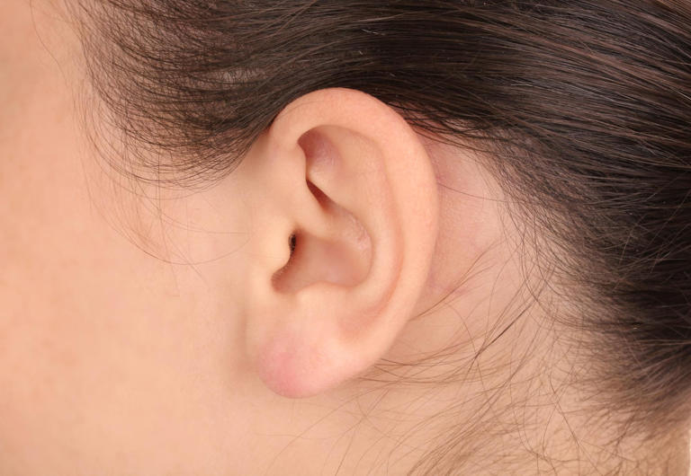 One letter in one gene determines which of two kinds of earwax you have ...