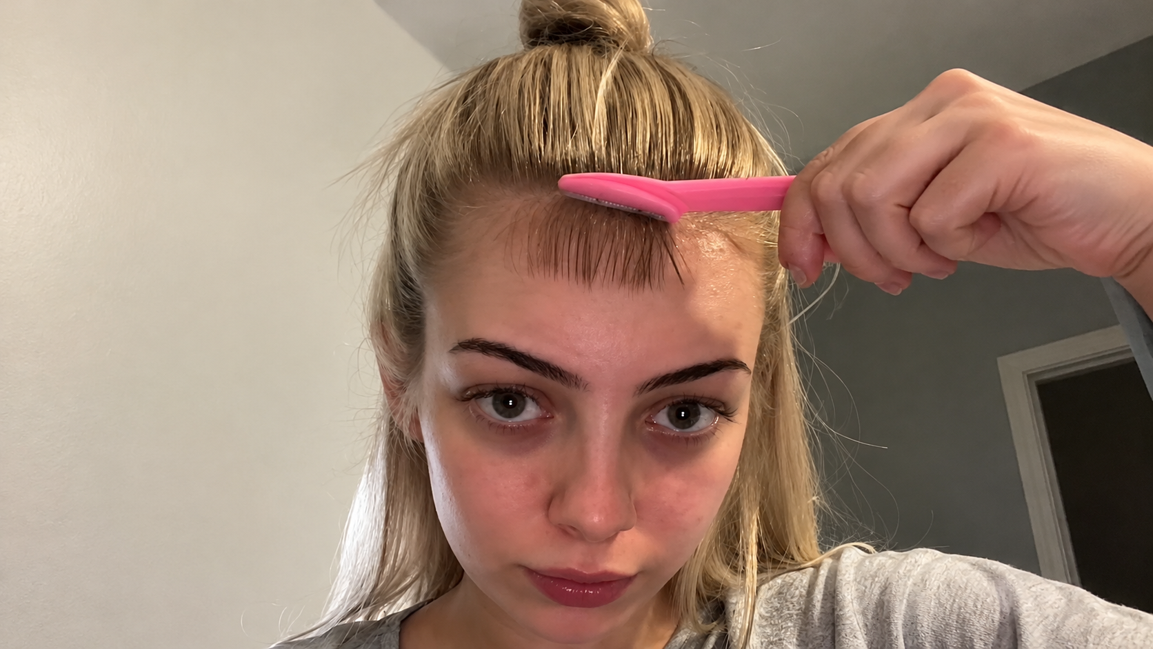 She accidentally shaved off her hairline - then spent eight months ...