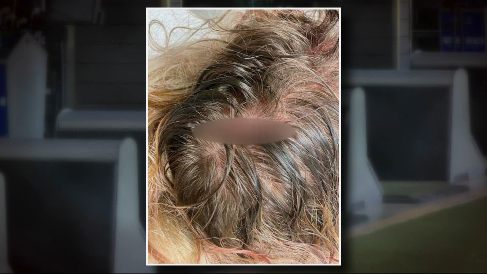 Woman wins multimillion-dollar settlement after Topgolf injury