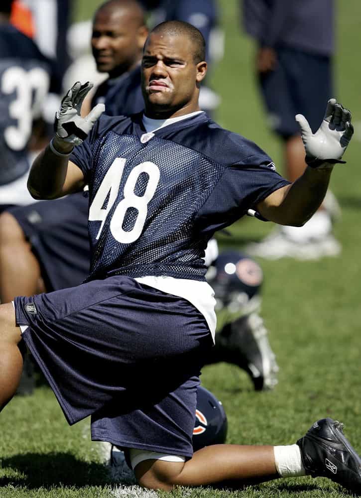 Celebrities who have vitiligo